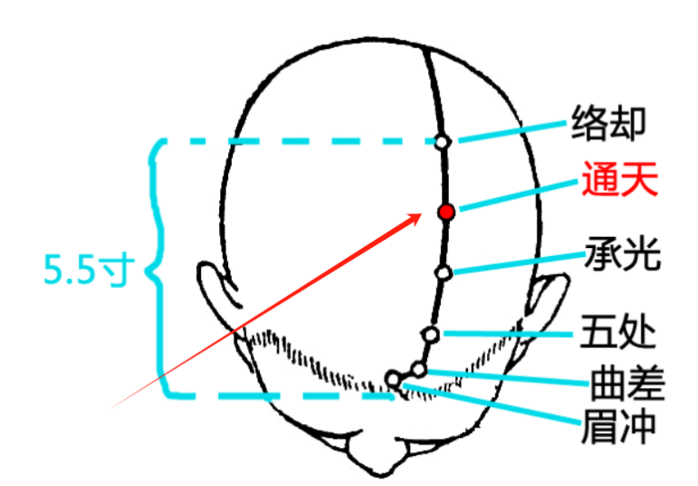 Acupuncture – Medical Cases（25）(Sun Peirong) - Regimen Motion